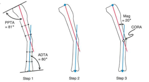 Deformity Correction of Lower Limb Bones/Basic Principles/Mechanical ...