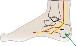 Orthoplastic Approach- Orthopedic