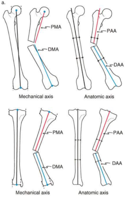 Mechanical and Anatomical Axis Planning - Frontal plane
