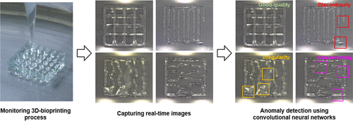 Application of artificial neural networks in 3D printing anomaly ...