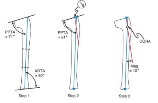 Deformity Correction of Lower Limb Bones/Basic Principles/Mechanical ...