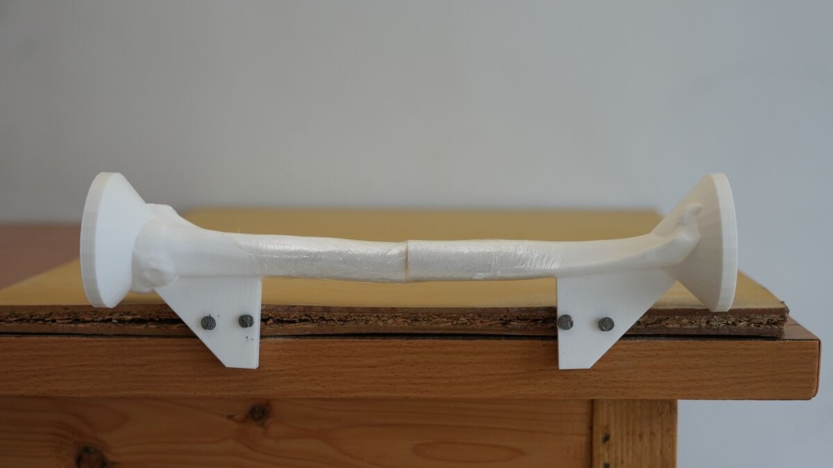 Humeral Shaft Transverse Fracture Simulator