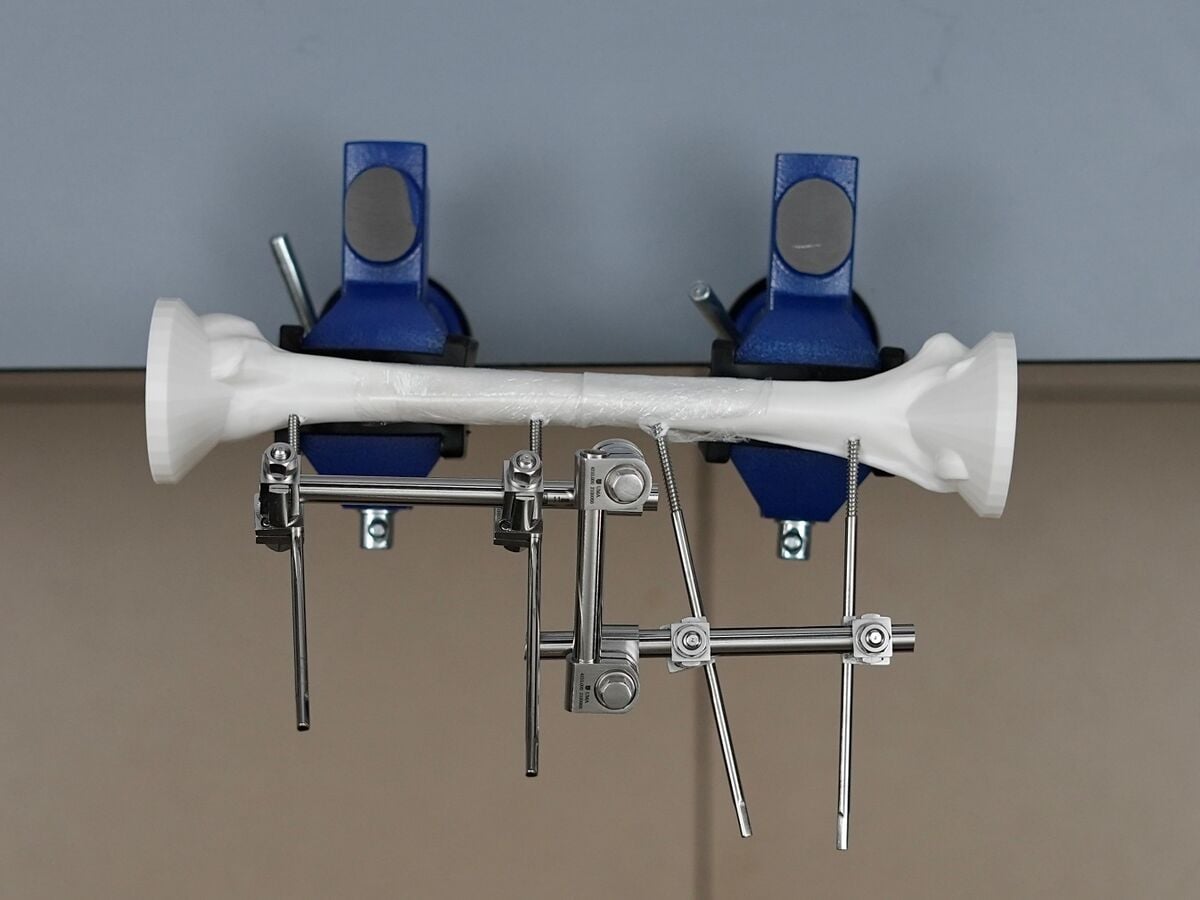 Humeral Fracture Fixation/Self-Assessment Framework