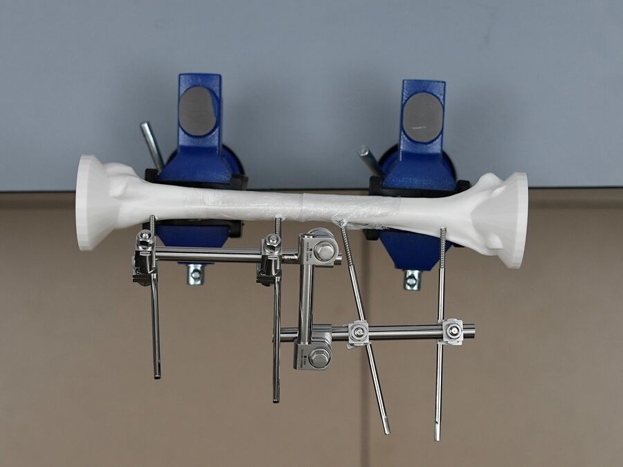 Humeral Fracture Fixation/Knowledge Review