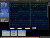 Open ephys - Appropedia: The sustainability wiki