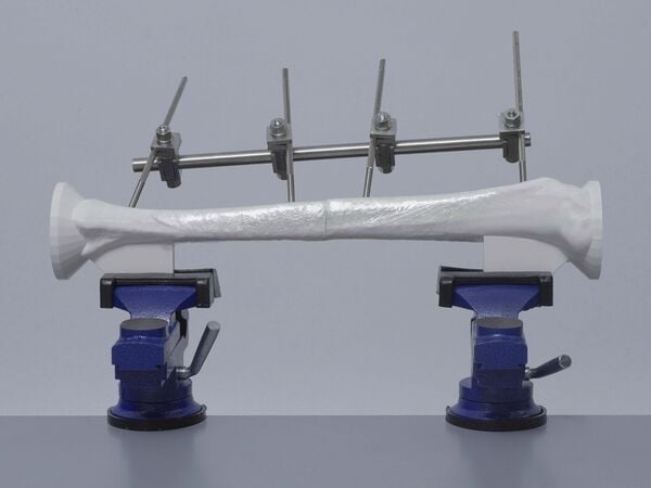 Uniplanar External Fixation/Self-Assessment Framework