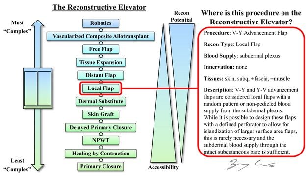 V-Y Advancement Flap - Background