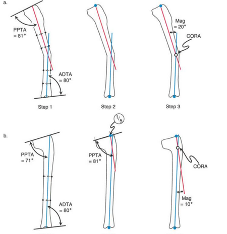 Mechanical and Anatomical Axis Planning - Sagittal plane