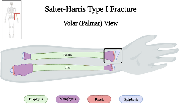 Pediatric Distal Forearm Fractures/Anatomy Review