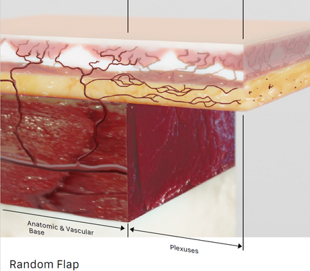 Flap Classifications & Relevant Anatomy