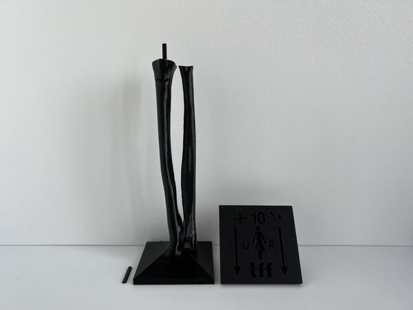 Pediatric Distal Forearm Fractures: Female Forearm Models