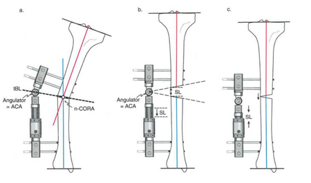 External fixation devices - Rail Fixator