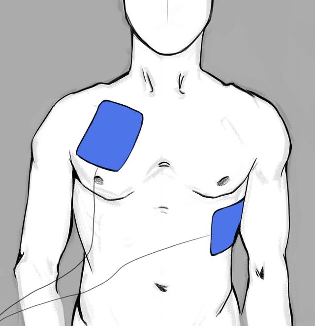 NREMT Skillset AED Application