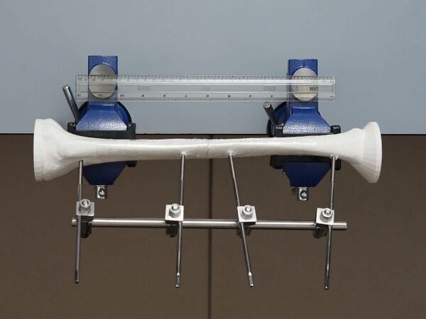 Uniplanar External Fixation/Self-Assessment Framework