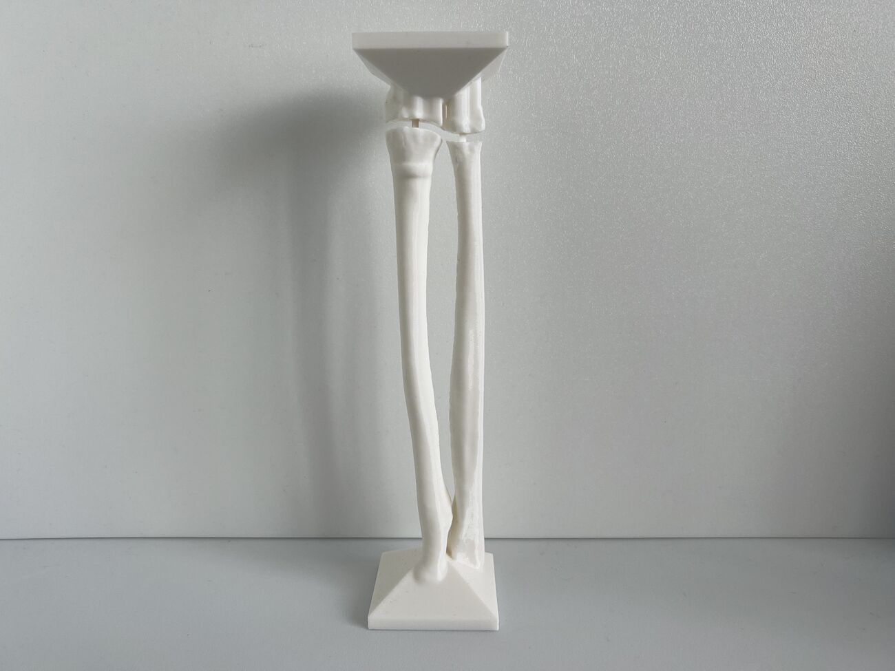 Pediatric Distal Forearm Fractures/Anatomy Review