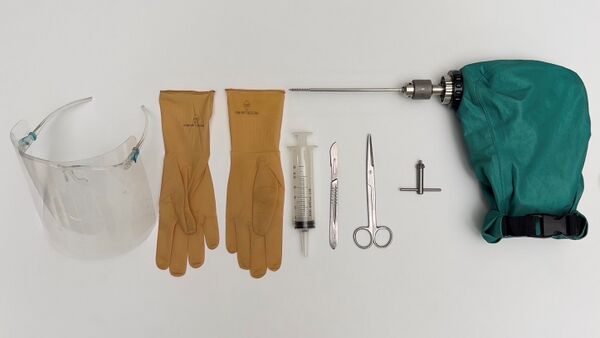 Modular External Fixation for Humeral Shaft Fracture