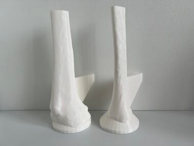 Uniplanar External Fixation/Tibial Shaft Transverse Fracture Simulator