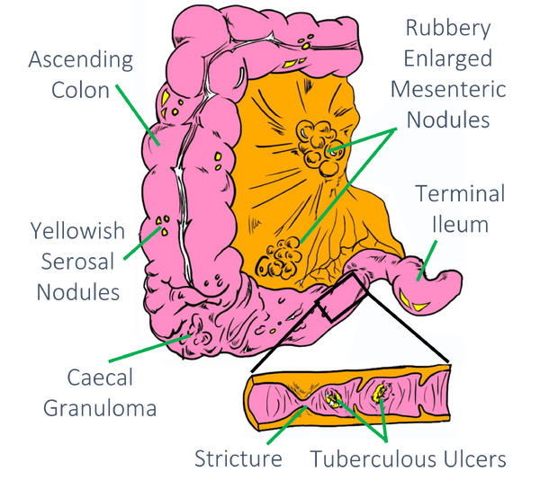 Differential Diagnosis - Appropedia, the sustainability wiki