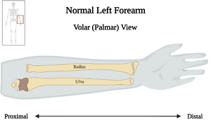 Pediatric Distal Forearm Fractures/Anatomy Review - Appropedia, the ...