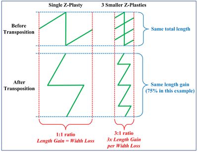 V-Y Advancement Flap - Background - GSTC